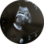 Imaging Technology - Alfa Scan Diagnostic Imaging